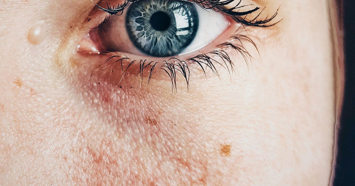 App per controllare i nei | Salvatore Aranzulla